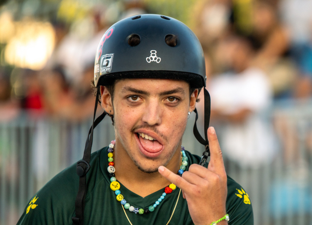 Thomas Augusto's Unusually Crooked Lips Indicate A Serious Health Issue