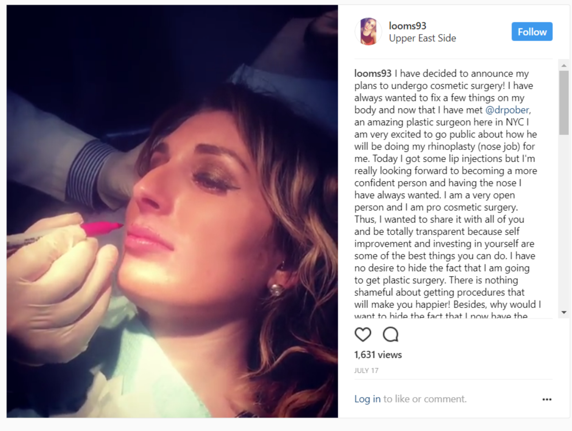 Laura Loomer's Cosmetic Surgery Journey: Speculations, Controversies ...